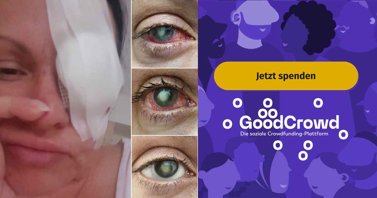 Anjas Augenlid-OP: Hilfe für eine neue Perspektive | GoodCrowd.org